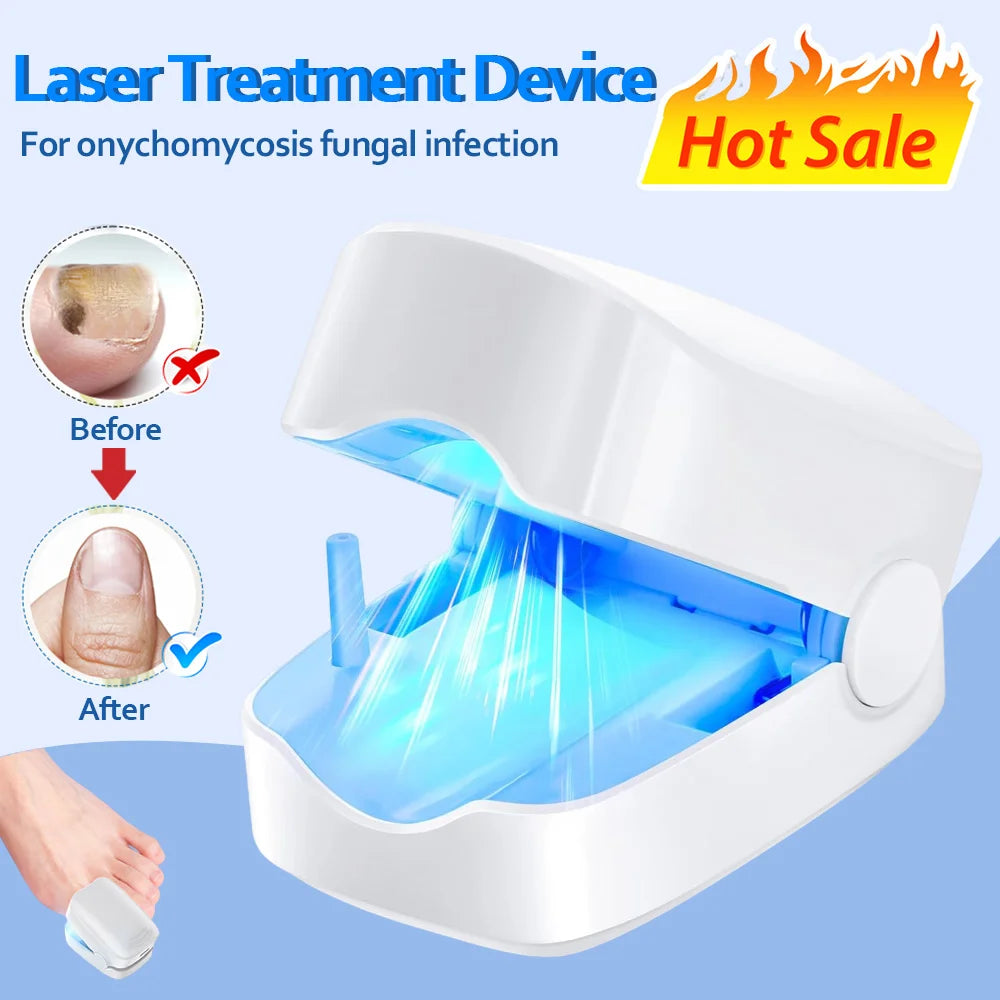 Portable Grey Nail Assist Tool UV Professional Nail Fungus Cleaning La ...